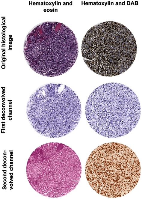 Using The Color Deconvolution Plugin An Image Of A Tissue Cores Double Download Scientific