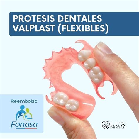 Prótesis Dentales Valplast Descubre Las Ventajas Y Desventajas Que