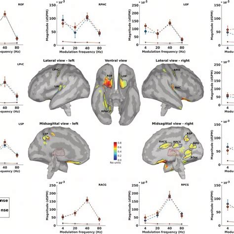The Auditory Steady‐state Response Assr Map Of Subcortical Regions Download Scientific