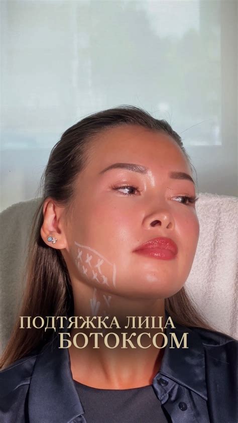 КОСМЕТОЛОГ НОВОСИБИРСК КРАСНОЯРСК Как подтянуть лицо и создать лифтинг эффект Ботокс