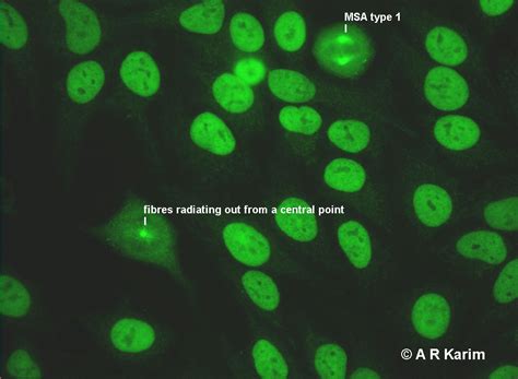 Ana Mixed Pattern University Of Birmingham