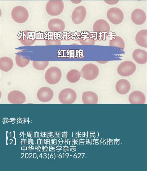 外周血细胞形态学习打卡—红细胞