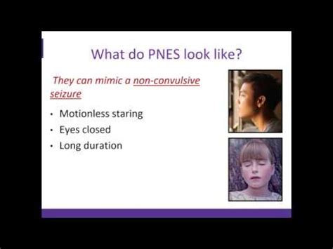An Overview Of Psychogenic Non Epileptic Seizures Pnes Youtube