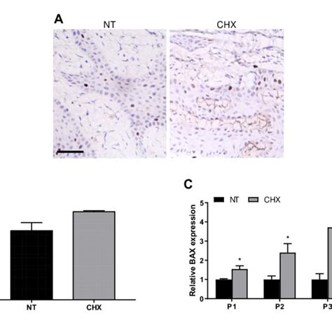 Chx Shows A Proapoptotic Effect In Gingival Tissues A Representative Download Scientific