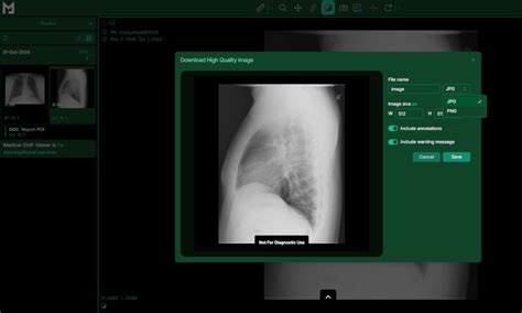 How To Convert Dicom To Jpeg In Minutes