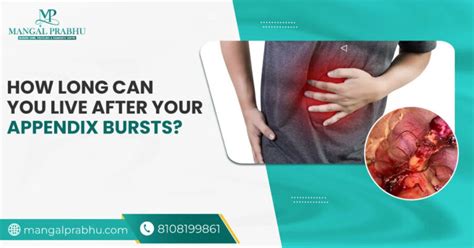 How Long Can You Live After Your Appendix Bursts