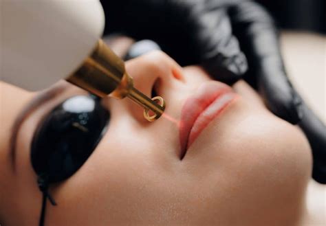 Causes Of Lip Hyperpigmentation And Treatment For Dark Lips