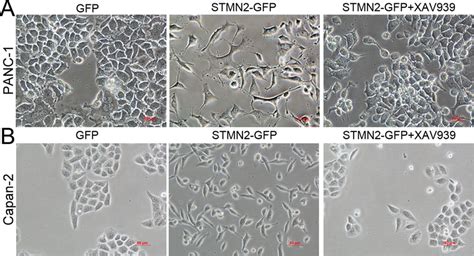 Cellular Morphology X200 Magnification In Vitro A Cellular Morphology