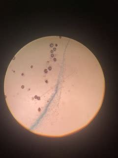 Microbiology Lab Microscope Slides Flashcards Quizlet