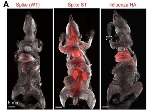 Sars Cov 2 Spike Protein Accumulation In The Skull Meninges Brain Axis … Agnes Laurence