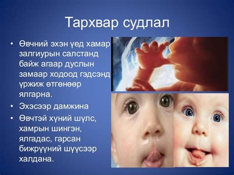 гар хөл амны өвчин