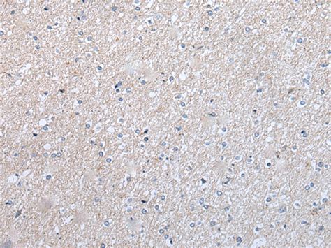 兔抗enpp2多克隆抗体anti Enpp2 Rabbit Polyclonal Antibody 生命科学产品与技术服务 生工生物工程