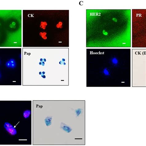 Subtyping Of Ctcs By The Current Cytology Based Ctc Detection Method