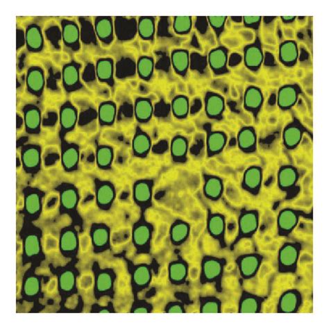 Series Of Six Exemplary Micro Ct Scan Slices Of The Explanted
