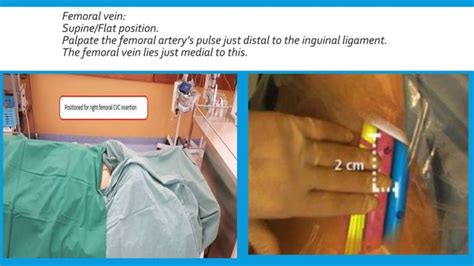 Central Line Placement PPTX First Aid Injuries