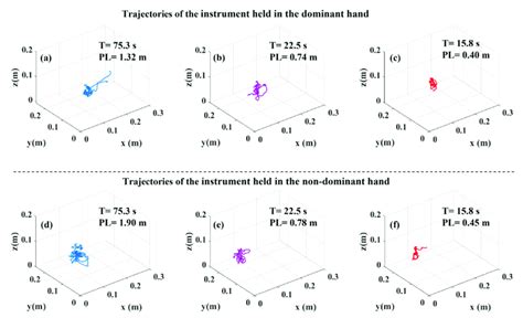 Representatives Of Tooltip Trajectory With Tooltip Path Length PL And Download Scientific