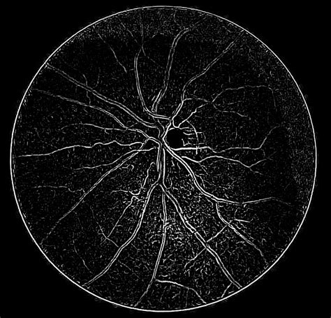 Overall Variations Of The Frangi Filter Gray Level Response A Image
