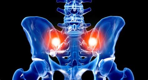 Genesys Spine Launches Siros O Transfixing Si Joint Fusion