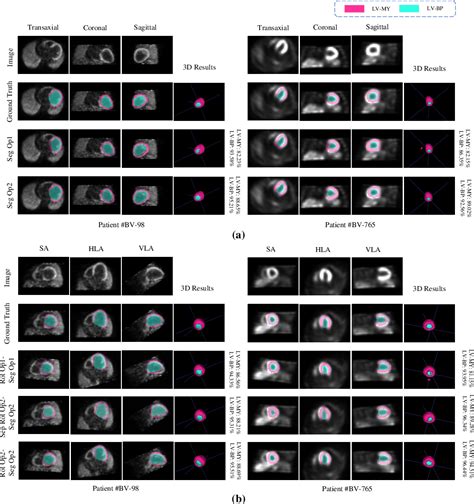 Figure 3 From A Multiscale Spatial Transformer U Net For Simultaneously Automatic Reorientation