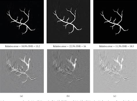 Figure 1 From Compressed Sensing Photoacoustic Imaging Based On Fast Alternating Direction