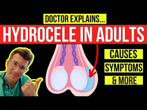 Hydrocele Treatment Without Operation