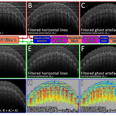 a single level wavelet decomposition of a ps oct structural image low