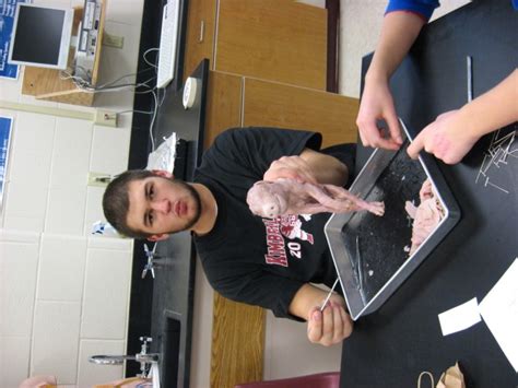 Unit 6 Skeletal System KHS Science