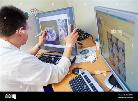 Imrt Intensity Modulated Radiation Therapy Abdomen Cancer 3d Radiotherapy Treatment Planning