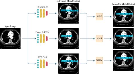 Figure 1 From Deep Learning In Computed Tomography Pulmonary Angiography Imaging A Dual Pronged
