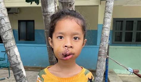 Success Ariya From Cambodia Raised 841 To Fund Surgery To Remove A Tumor Watsi