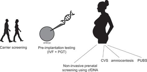 Genetic Diagnosis In The Fetus Journal Of Perinatology Nael Ismail