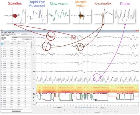 GUI Integration Of The Automatic Event Detection The Top Row Download Scientific Diagram