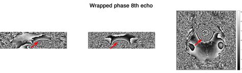 Choosing A Right Phase Unwrapping Method For Your Data SEPIA 1 2 0 Documentation