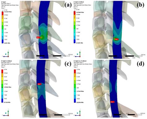 Bioengineering Special Issue Application Of Computational Models In