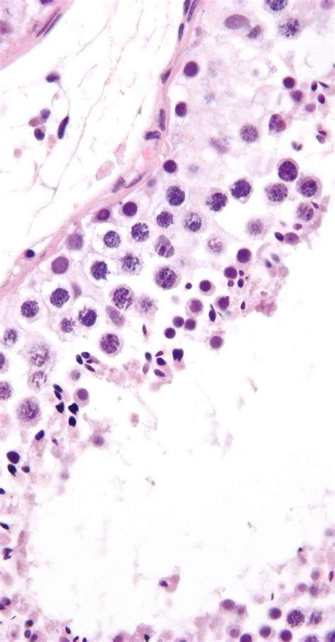 What Is The Difference Between Spermatogenic Cell And Spermatogonia