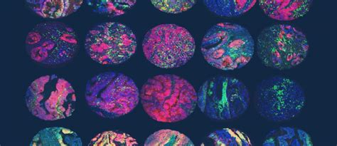 Tumor Heterogeneity Plasticity And Therapy Virtual Edition Vib