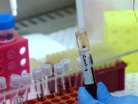 Video A Simple Flow Cytometric Method To Measure Glucose Uptake And Glucose Transporter