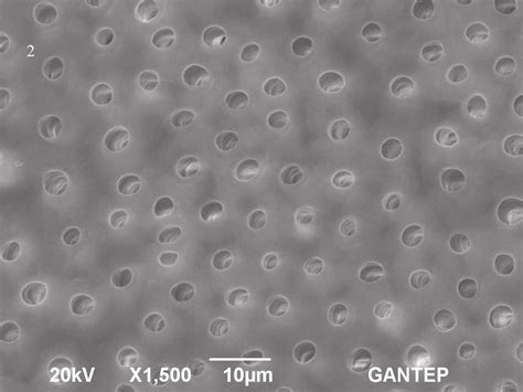 Sem Image Of The Dentin Surface After Application Of Acid Etching