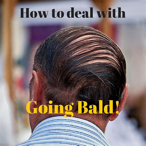 How To Deal With Going Bald Whats The Best Haircut When You Are Going