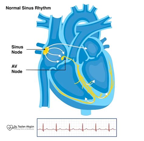 Arrhythmias Symptoms Causes And Treatment
