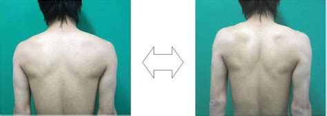 The Function Of Scapular Muscle IntechOpen