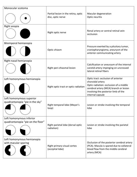 Visual Field Defects Anatomy And Lesions Diagram
