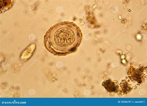 Hymenolepis Diminuta Egg Human Parasite In Stool Examination Stock
