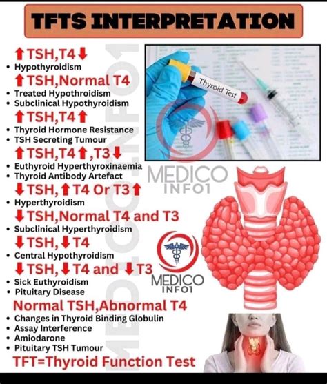 Thyroid Function Test Interpretation Most Of Us Knew About Hypo