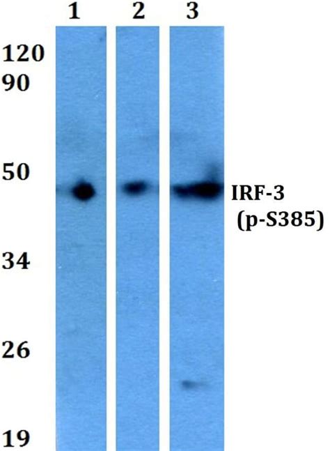 Invitrogen Phospho Irf3 Ser385 Polyclonal Antibody 100 μl