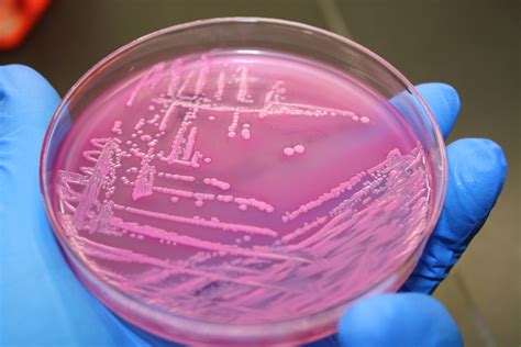 Escherichia Coli Bacterium