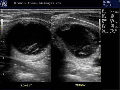 A Gallery Of High Resolution Ultrasound Color Doppler And 3d Images