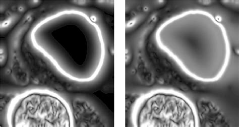 Magnitude Of The Vector Field After Running Gradient Vector Flow Gvf