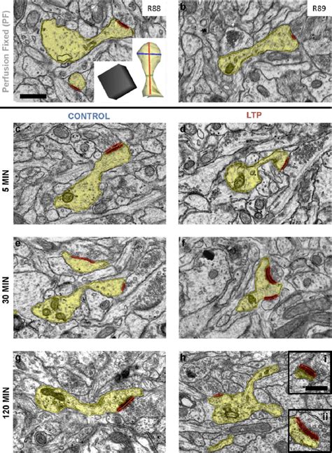 Representative Electron Micrographs From Perfusion Fixed Hippocampus Download Scientific