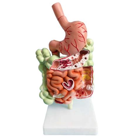 Cdik Human Digestive System Model Stomach Anatomy Intestine Cecum